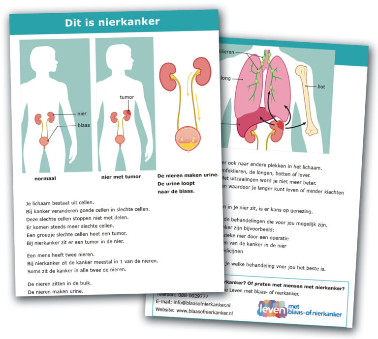 Praatkaarten - Nierkanker - Pharos