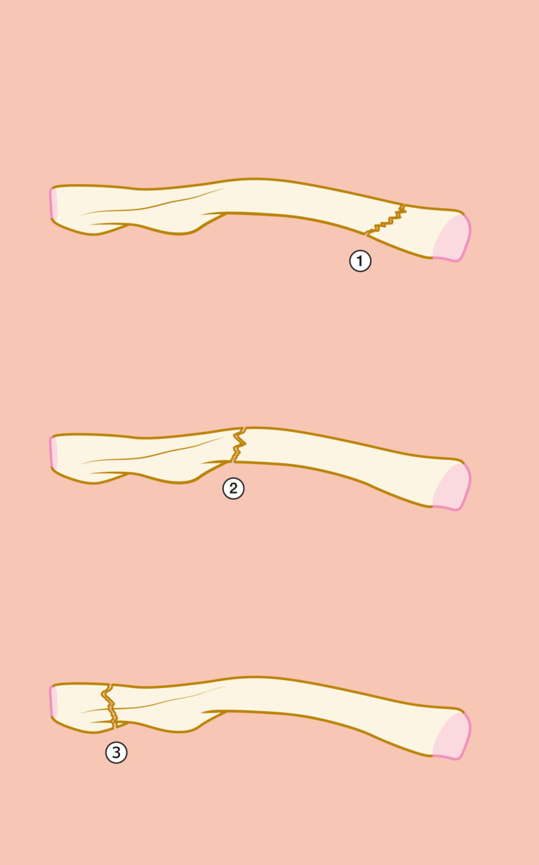 Begrijp je lichaam - Pharos